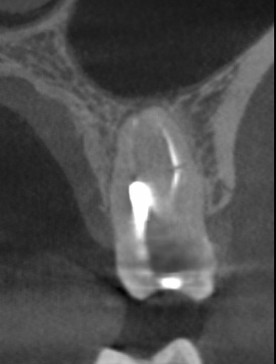 Western Connecticut Endodontics – Dr. H Lee